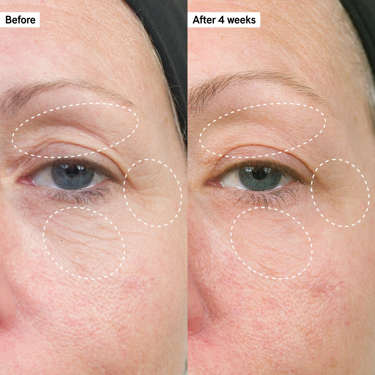 Ceramide Enriched Moisturizer to Restore & Hydrate Skin | The INKEY List